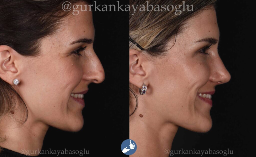 Prof. Dr. Gurkan Kayabasoglu - European Board Certified Surgeon in Turkey