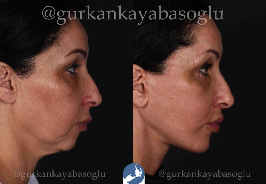Prof. Dr. Gurkan Kayabasoglu - European Board Certified Surgeon in Turkey