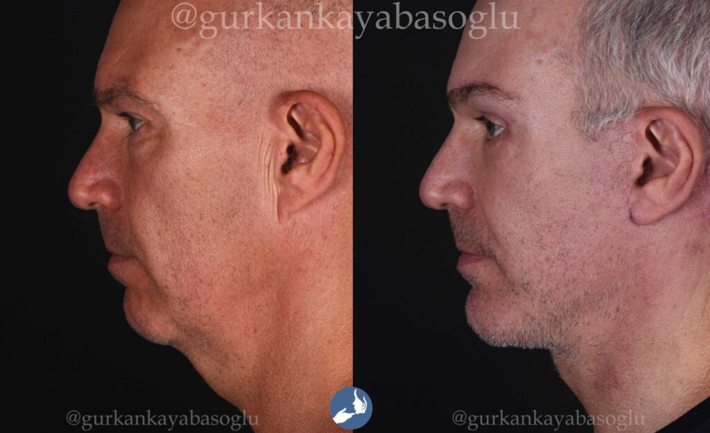Prof. Dr. Gurkan Kayabasoglu - European Board Certified Surgeon in Turkey